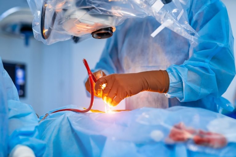 Vascular Surgery - Dr. G. Viswanathan Hospital
